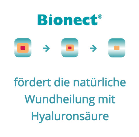 Bionect® zur Wundheilung und Schutz Ihrer Wunde | Mit Hyaluron